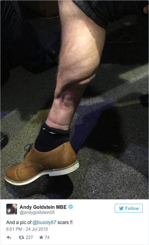 Remember Dave Busst's horrific leg break? Here's how it looks 19 years ...